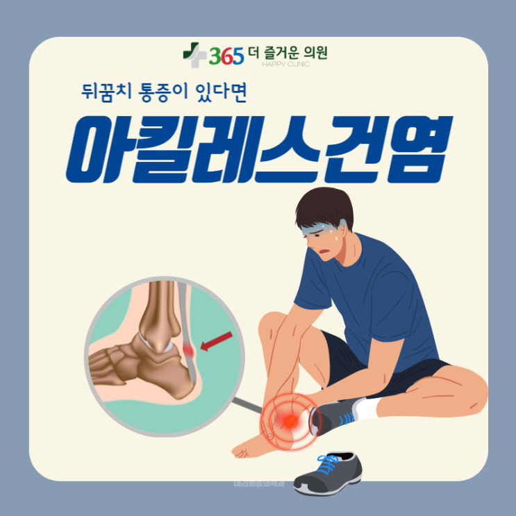 새솔동 안산 관절통증 발뒤꿈치 찌릿한 아킬레스건염 이라면 네이버 블로그