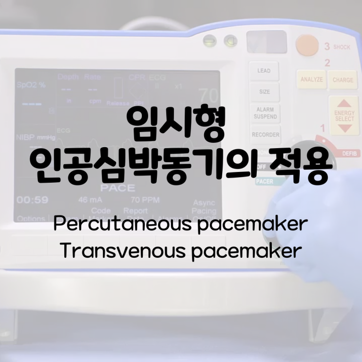 임시형 인공심박동기의 적용 - Percutaneous pacemaker, Transvenous temporary ...