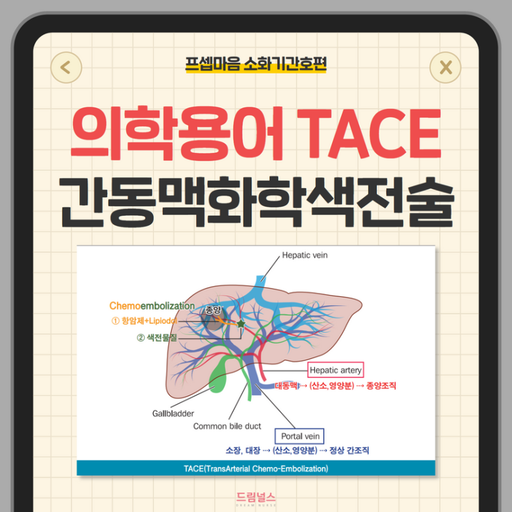 의학용어 TACE 시술 전 간호, 주의사항까지 : 네이버 블로그