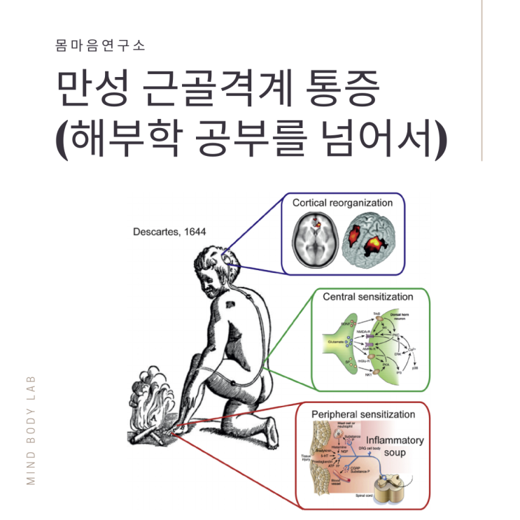 만성 근골격계 통증 해부학 공부를 넘어서야 해결할 수 있다 네이버 블로그