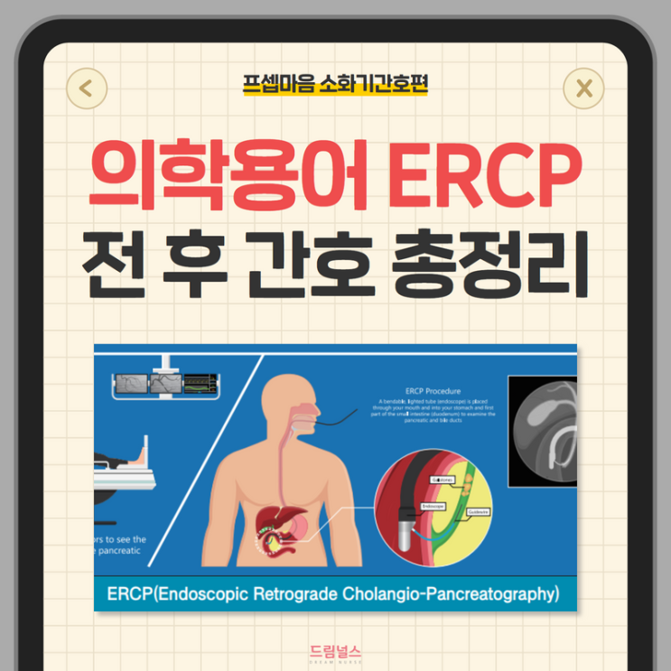 의학용어 ERCP 목적, 방법, 전 후 간호 : 네이버 블로그