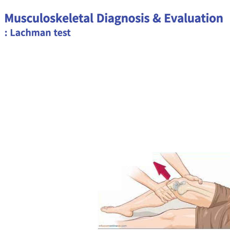 Lachman test : 라크만 테스트 - ACL 손상 평가 : 네이버 블로그