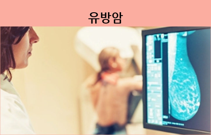 여성 초기 유방암 종류 증상과 원인 예방 치료법 네이버 블로그