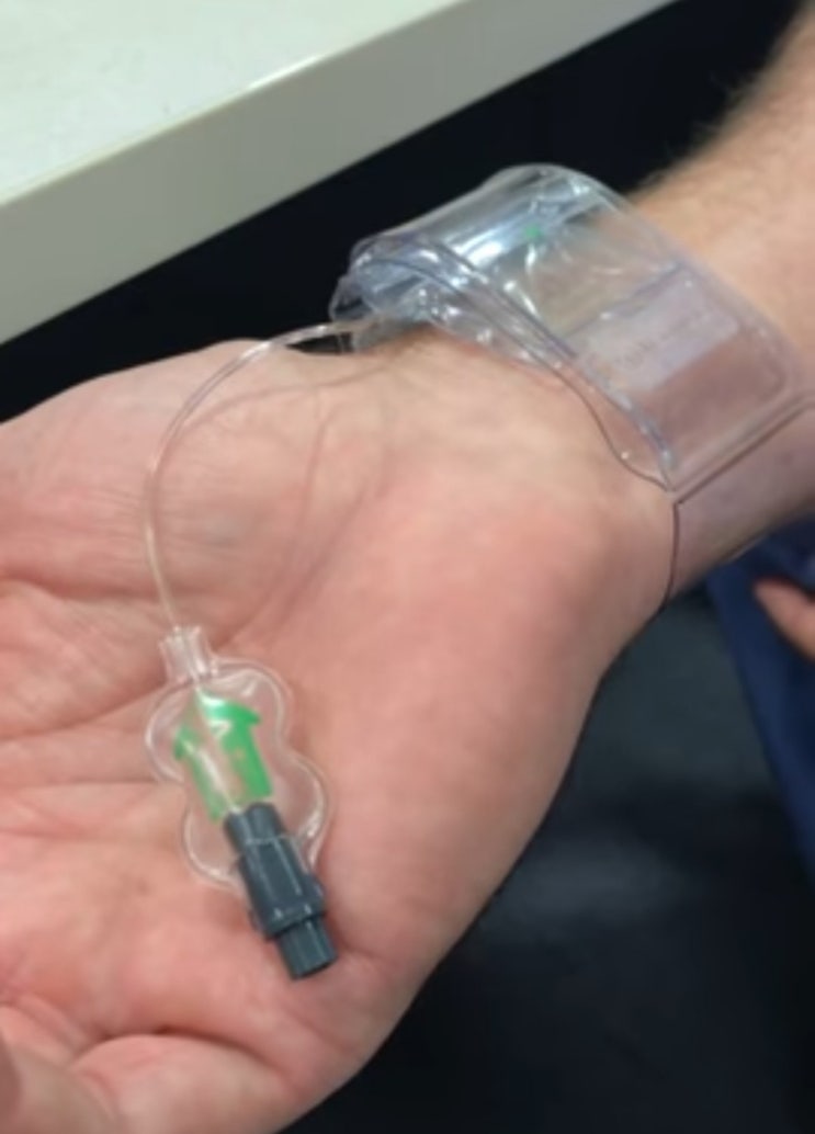 TR band, Radial compression device, 손목지혈밴드 : 네이버 블로그