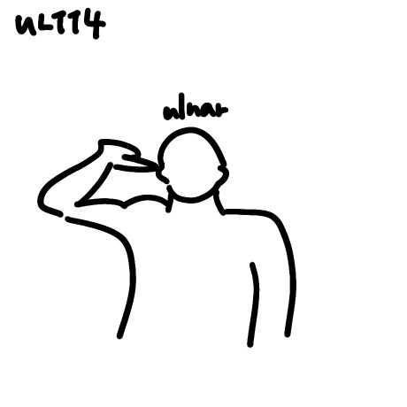 상지긴장검사ULTT(Upper Limb Tension Test) 자세 : 네이버 블로그