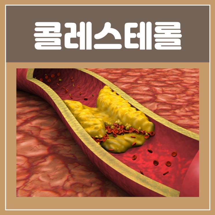 콜레스테롤 뜻 낮추는 방법 약 크레스토 고밀도 저밀도 정상 콜레스테롤 수치 Hdl Ldl 정상수치 네이버 블로그