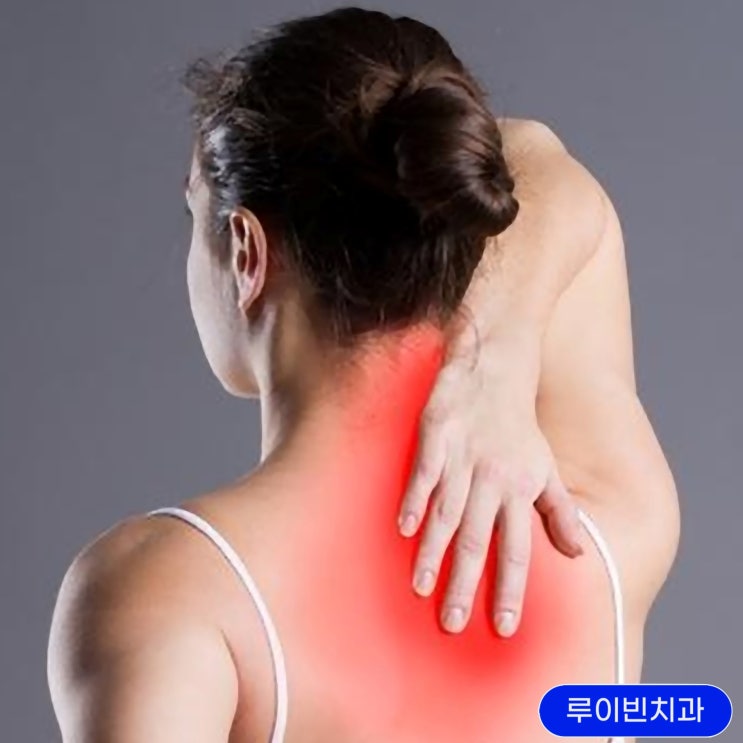 등 날개뼈 통증 잠 설치는 근막동통 증후군 원인 3가지와 치료법 네이버 블로그