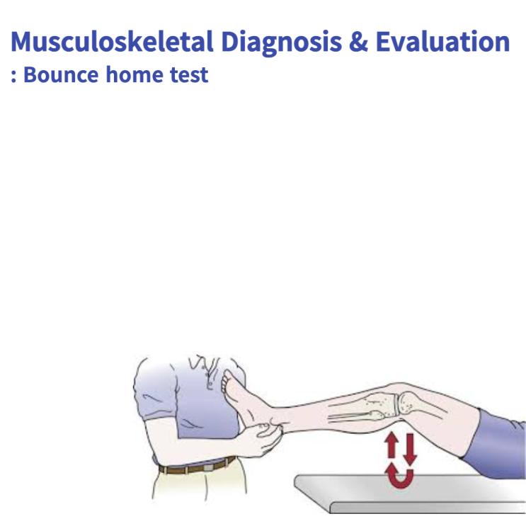 Bounce home test : 바운스 홈 테스트 (되튀김 검사) - 반월판 손상 : 네이버 블로그