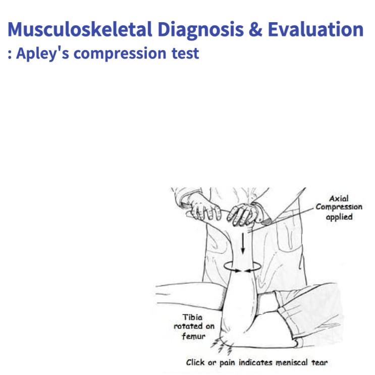 Apley's compression test : 아플레이 압박 검사 - 반월판 손상 : 네이버 블로그