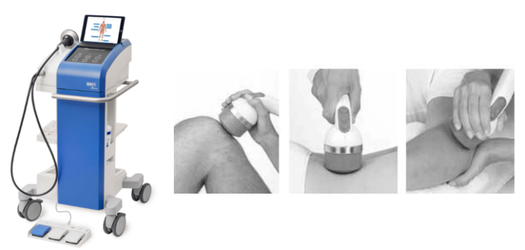 체외 충격파 치료란? (ESWT) : 네이버 블로그