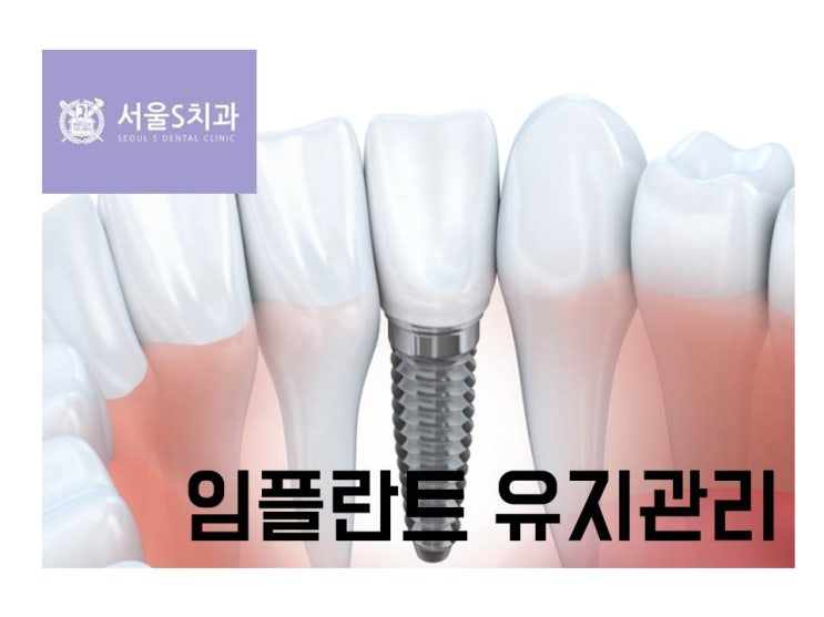 지축 치과 서울에스치과 임플란트 시술 후 사후 유지관리도 꼭 잊지 말고 받으세요 😉 네이버 블로그