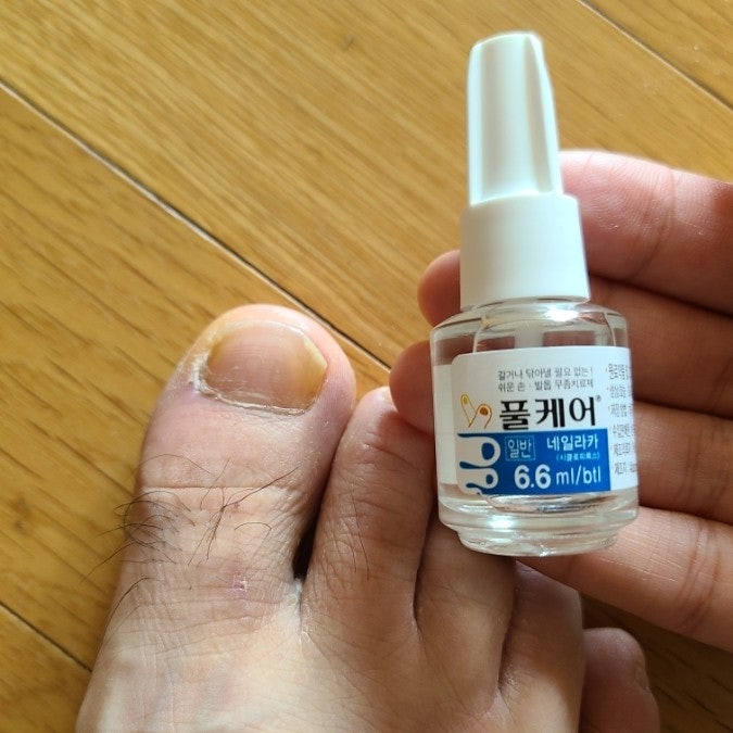 발톱무좀치료방법 바르는 발톱무좀약 풀케어네일라카로 집에서 쉽게 네이버 블로그