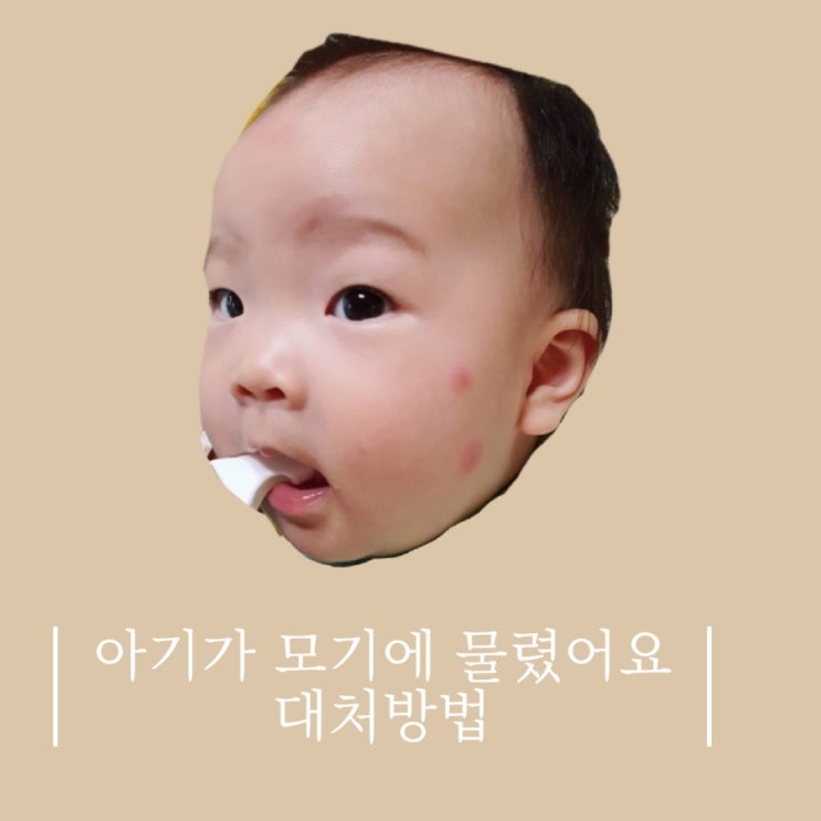 아기 모기 물렸을 때 대처방법 못 긁게 하는 방법까지 네이버 블로그