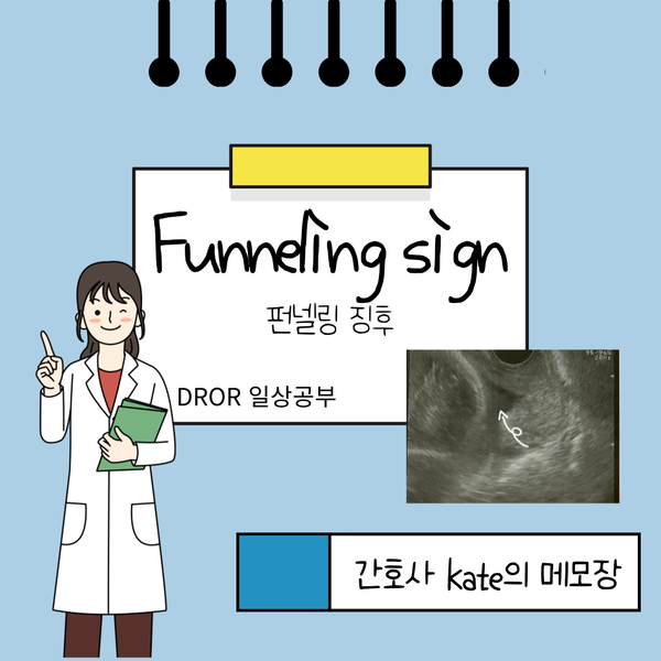 [DROR 일상공부] Funneling;펀넬링, Preterm labor(자궁조기수축)와 Funneling(자궁목 깔대기변화 ...