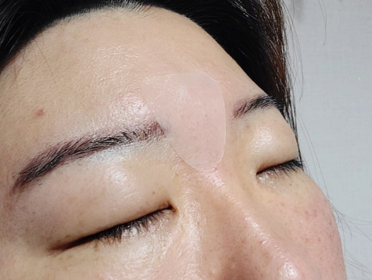 안티에이징 필수템 마르시끄 미간패치로 팔자주름 없애기 도전 네이버 블로그