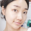 화농성여드름 턱좁쌀여드름 닥터딥 아크파 스킨로션 3종으로 관리해 네이버 블로그