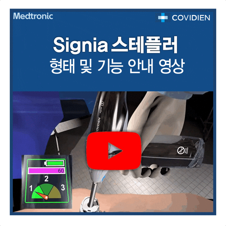 [동영상]Signia 스테이플러 구조와 기능에 대한 안내 : 네이버 블로그