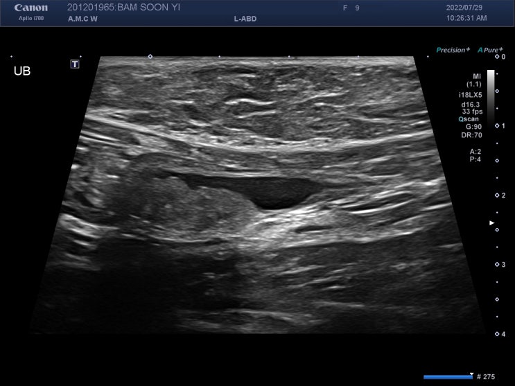 [증례] 방광종양(TCC)로 진단된 고양이에서 이뮤코텔 Immucothel 과 셀레나제 Selenase 로 항암치료한 증례 ...