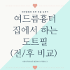 여드름흉터 자가 Tca 도트필로 없애는 방법 네이버 블로그