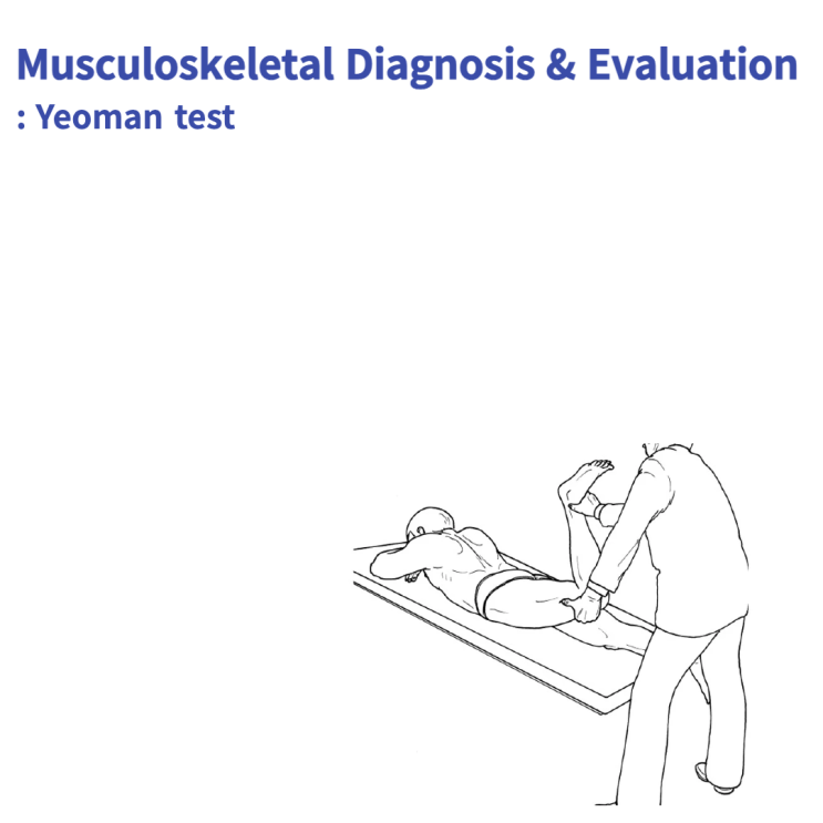 Yeoman test : 요만 테스트 - 앞쪽 엉치엉덩관절 인대 손상 , 허리뼈 손상 : 네이버 블로그