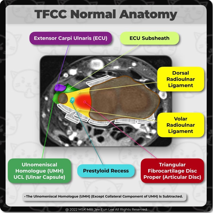 [Anatomy_23] Triangular fibrocartilage complex (TFCC), wrist MRI : 네이버 블로그