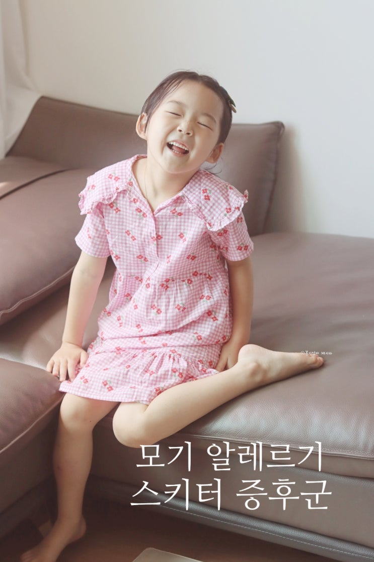 모기 물렸을 때 모기약 연고 모기 알레르기 스키터 증후군 잘 붓는 아이 네이버 블로그