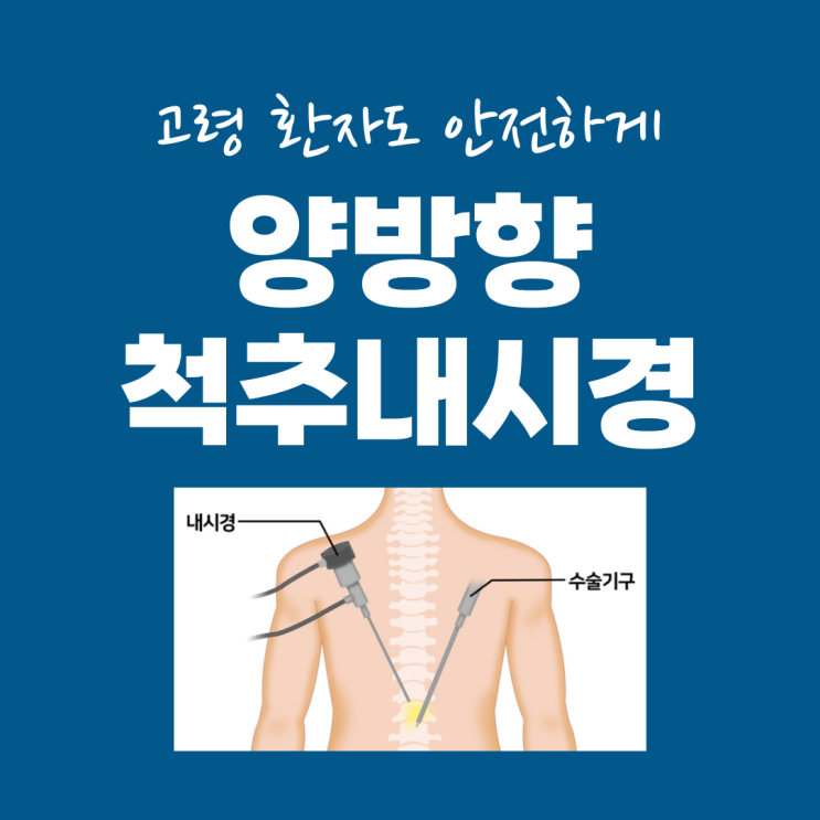금천구 정형외과 허리디스크 척추 협착증 수술 고령 환자도 안전하게 수술 가능한 양방향척추내시경bess 새움병원 네이버 블로그
