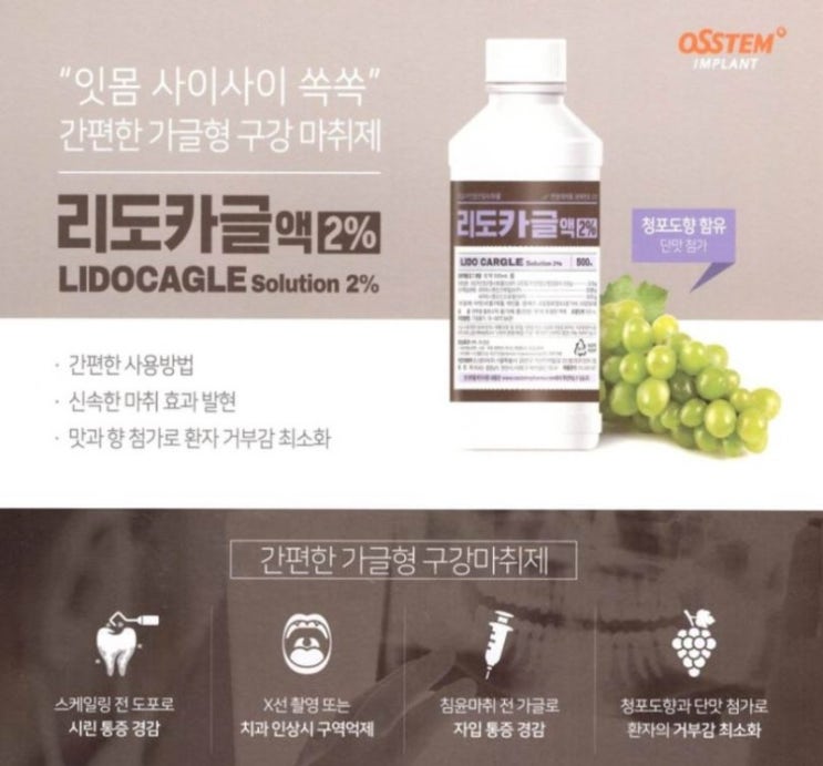 방이역치과스케일링 할 때 이가 시리세요 가글마취 로 편안하게 받으세요 네이버 블로그