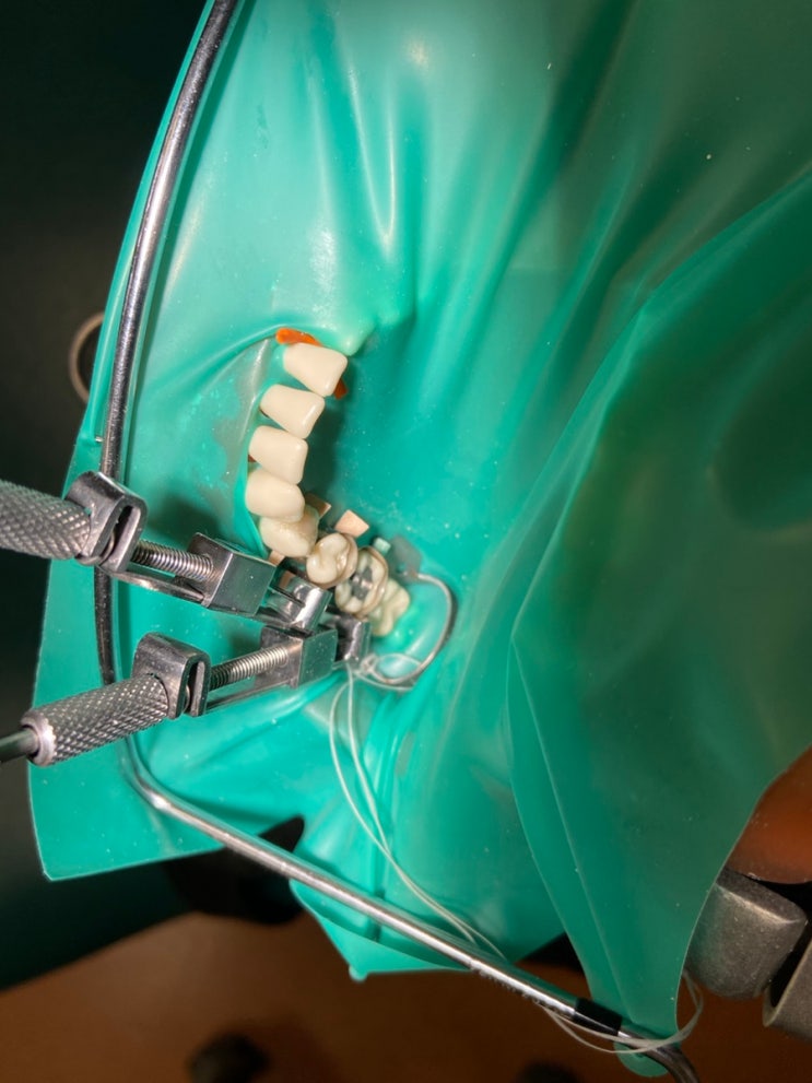 캐나다 오타와에서 덴탈 어시스턴트로 일하기 - 학교 선택하기 : 네이버 블로그