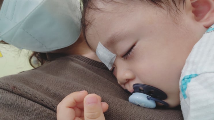 아기 얼굴 찢어짐 사고 아기 얼굴 상처와 응급실 창상봉합술 네이버 블로그