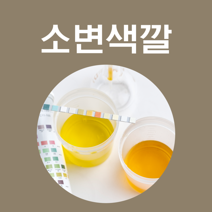 오줌 소변 색깔 무색 노란색 아침 거품뇨 단백뇨 거품 요단백 갈색 혼탁한 농뇨 소변색이 탁해요 소변에 피 주황색 투명한 당뇨