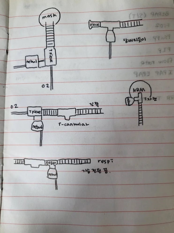 ICU 내 Tracheostomy, Intubation, Central line 준비(그외 tube 모음) : 네이버 블로그