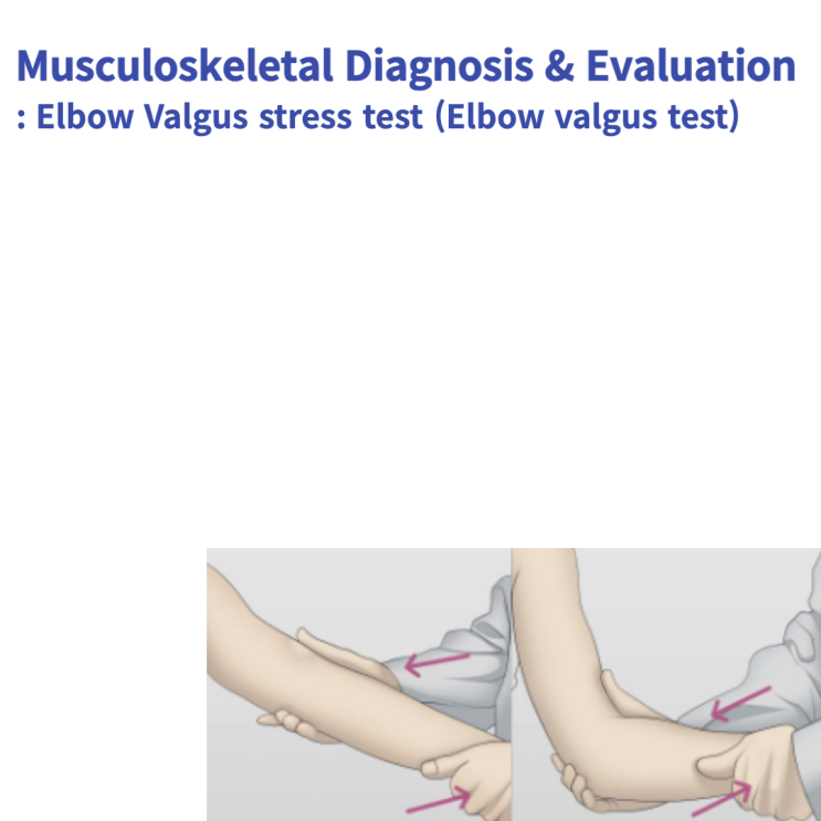 Elbow Valgus stress test (Elbow valgus test) : 팔꿈치 밖굽이 스트레스 검사 - Elbow ...