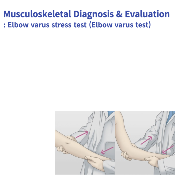 Elbow varus stress test (Elbow varus test): 팔꿈치 안굽이 스트레스 검사 - Elbow LCL ...