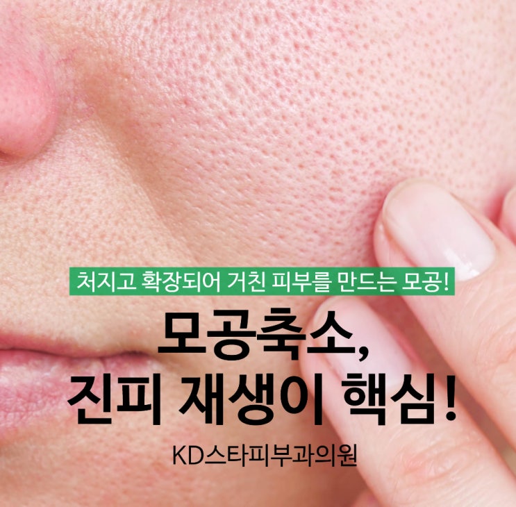 고덕역피부과버츄rf 피코웨이 레이저의 모공축소 효과는 진피재생이 핵심 네이버 블로그