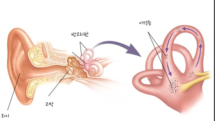 어지러움 증상 및 머리 어지럼증 원인전정신경염 이석증 치료 병원 네이버 블로그