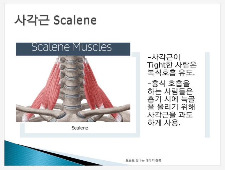 신경 혈관 증상 팔 저림 손과 팔의 마비감 어깨에서 손가락까지 통증 가슴에서 팔 통증 쇄골 통증 가슴과 어깨 통증