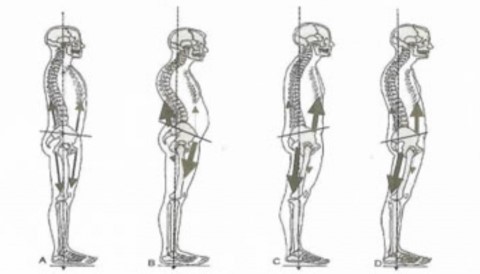 이상적인 정렬 - 측면 (Ideal Alignment - Lateral View) 상태 확인하기 : 네이버 블로그