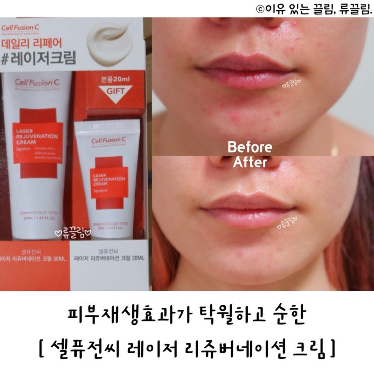 재생크림 추천 피부재생효과 빠방한 크림 셀퓨전씨 레이저크림 네이버 블로그