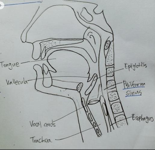 piriform sinus : 네이버 블로그
