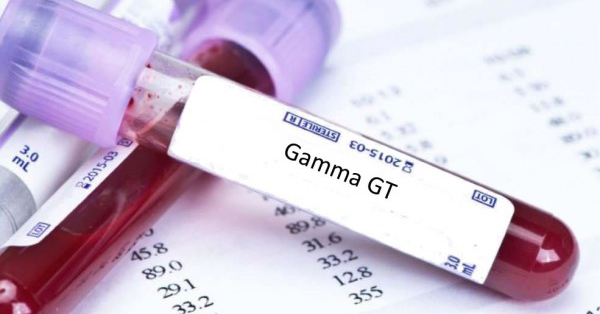 GGT 간기능 검사(Gamma-Glutamyl Transferase Test) : 네이버 블로그
