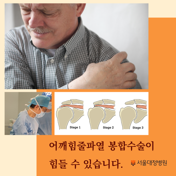 어깨힘줄파열 봉합수술 안된다 천안어깨치료 의사 네이버 블로그
