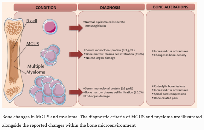 단세포군감마글로불린병증 Monoclonal gammopathy of undetermined significance (MGUS ...