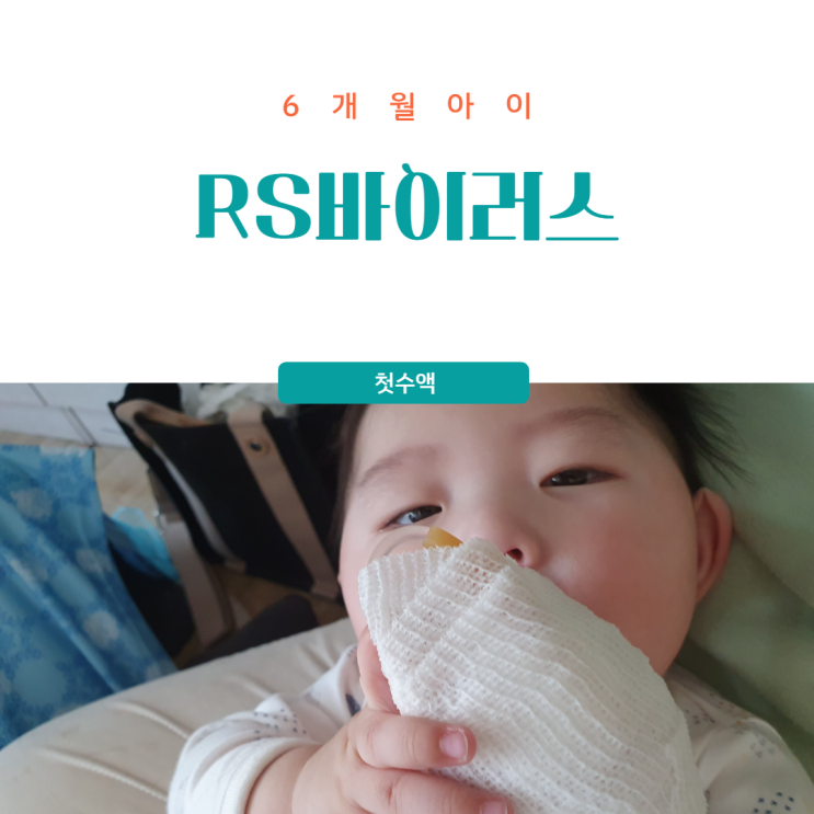 Rs바이러스 모세기관지염 6개월아기가 잘 걸리는 이유 네이버 블로그