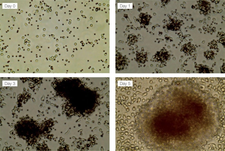 Accurately Count PBMCs & Measure Viability without Lysing RBC : 네이버 블로그