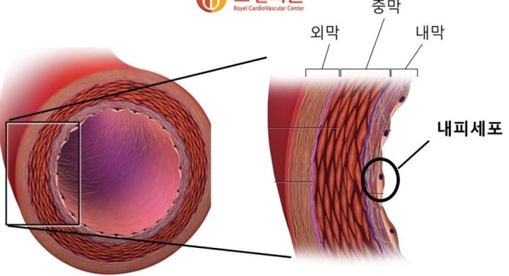 고혈압 조절 성기능개선 젊어지는 영양소 산화질소 만드는 영양제엔오부스터 네이버 블로그