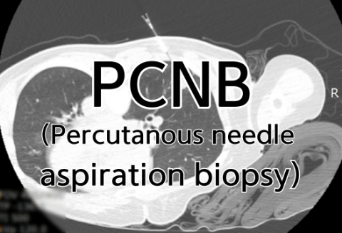 [간호지식] PCNB(Percutanous needle aspiration biopsy) 경피적 세침 흡인 폐생검 : 네이버 블로그