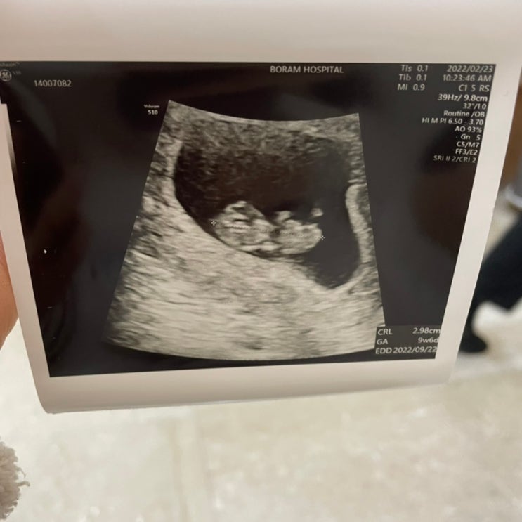 9w6d 울산 보람병원 산부인과((병원옮기기)) : 네이버 블로그