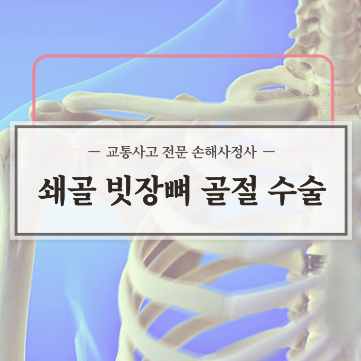 쇄골 빗장뼈 골절 교통사고 수술하면 달라질까요나란히 파헤쳐요 네이버 블로그