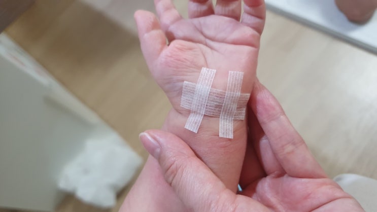 선천성 멜라닌모반 제거 수술 실밥 제거 후 관리 스테리 And 흉터밴드 네이버 블로그